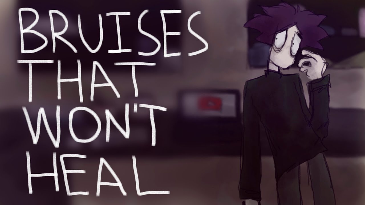 bruises that won't heal - YouTube