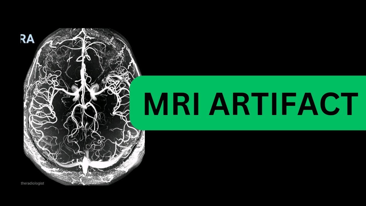MRI ARTIFACT||Radiology notes||MR artifact|| - YouTube