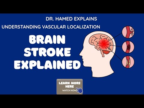How to do stroke localization in 15 minutes - YouTube