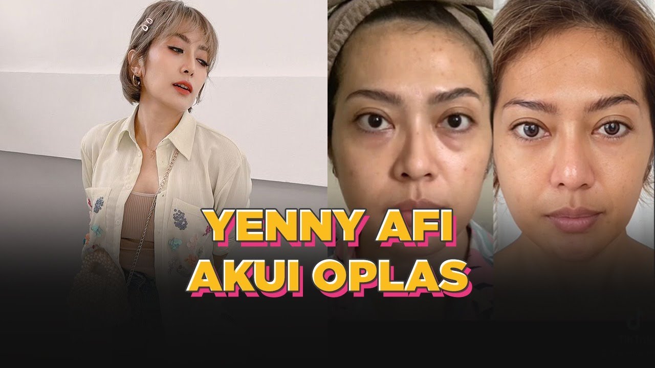 Transformasi Yenny AFI yang Jujur Akui Oplas - YouTube
