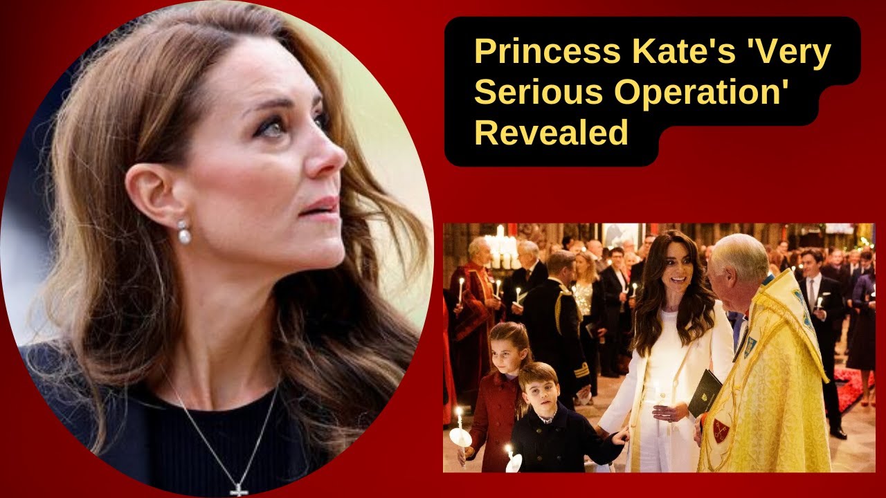 Royal Surgery Shock: Princess Kate's 'Very Serious Operation' Revealed ...