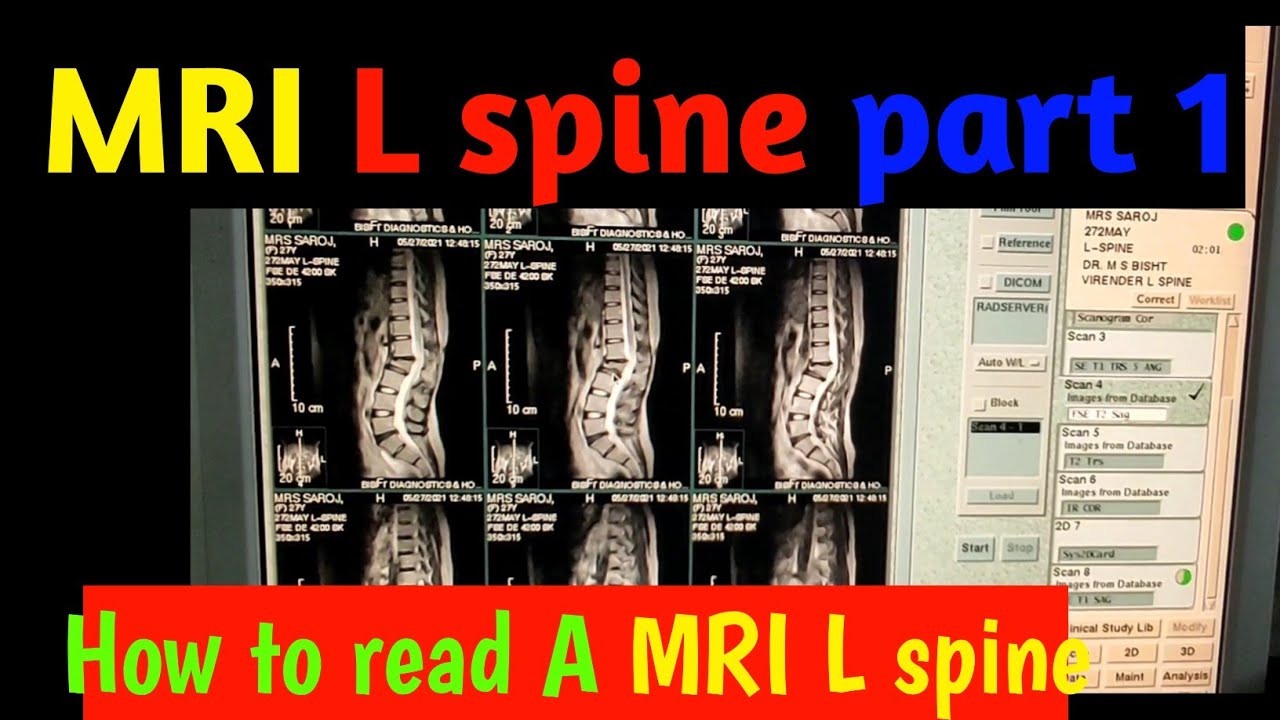 MRI L S spine scan, protocols & planning Part 1 || L spine fracture ...