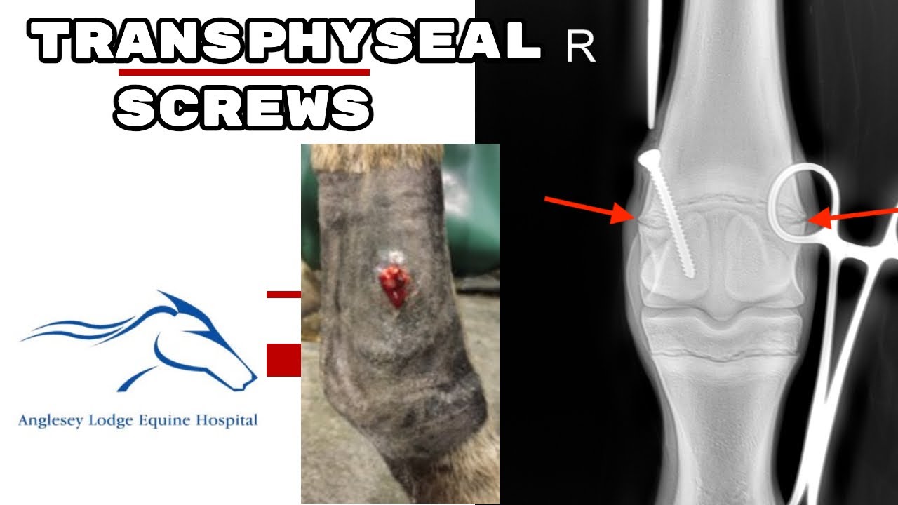 Transphyseal Screws for crooked foals - YouTube