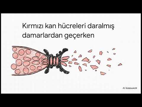 TROMBOTİK MİKROANJİYOPATİLER
