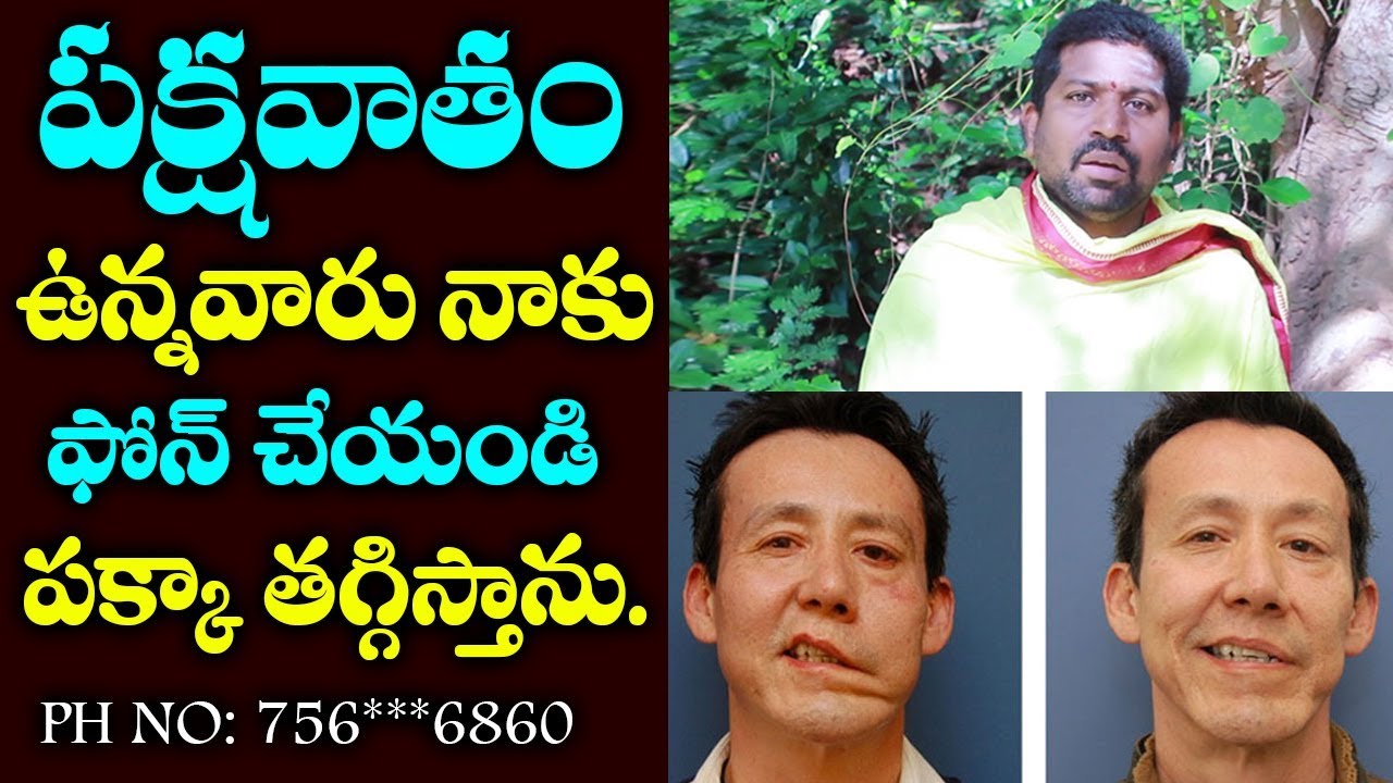 మాయదారి పక్షవాతం రోగాన్ని 1 మండలంలో తగ్గిస్తా మళ్లీ దాని గొడవే ఉండదు ...