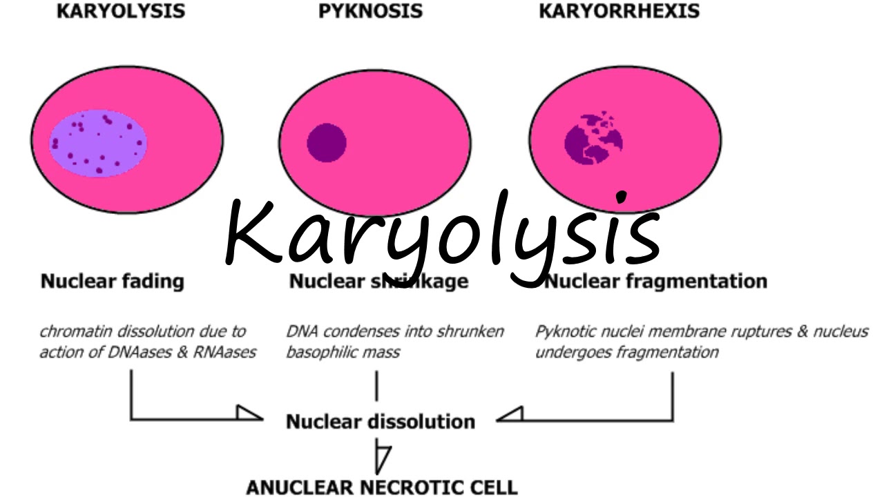 How to Pronounce Karyolysis? - YouTube