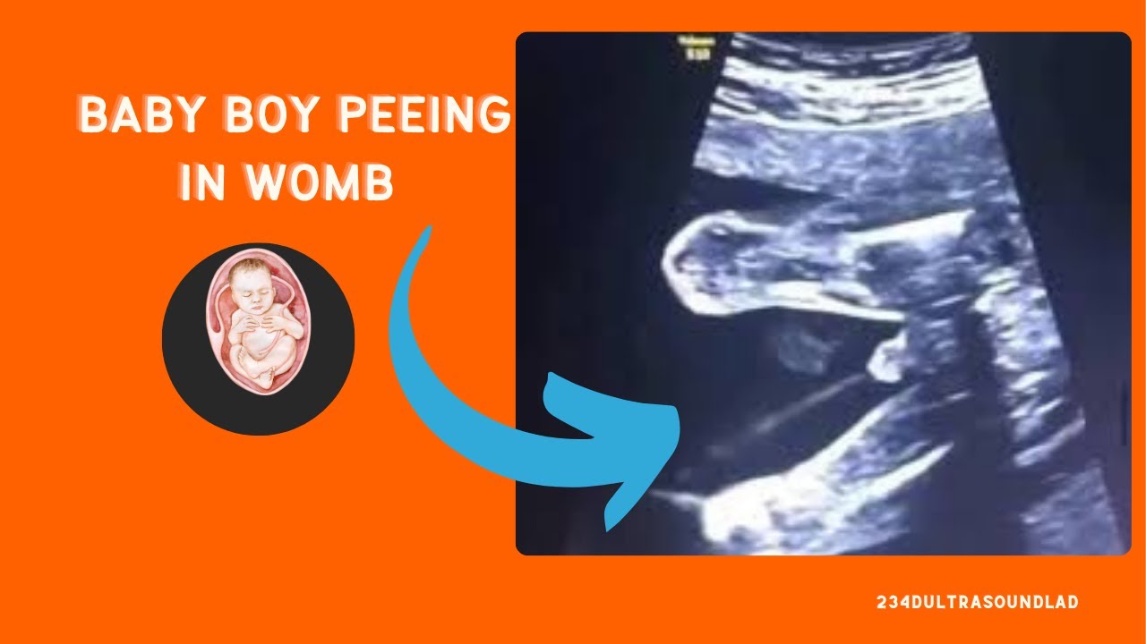 Ultrasound of Baby BOY peeing in womb #ultrasound - YouTube