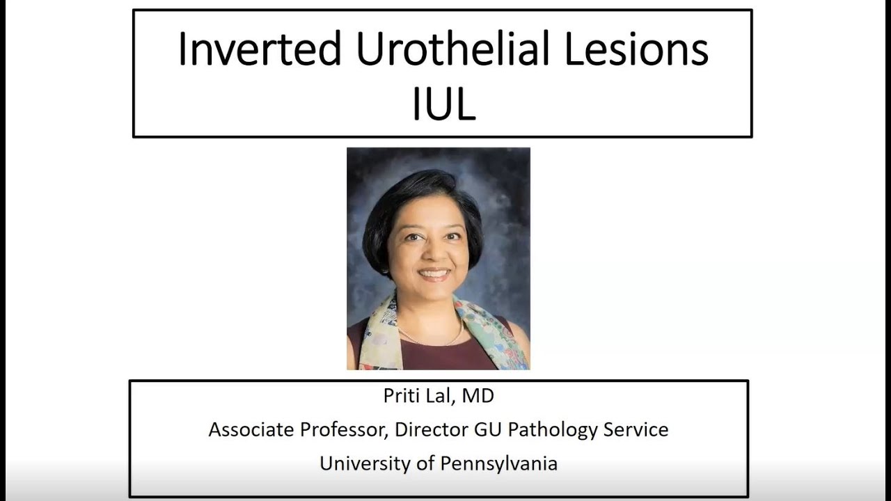 Inverted (endophytic) Urothelial Lesions - YouTube