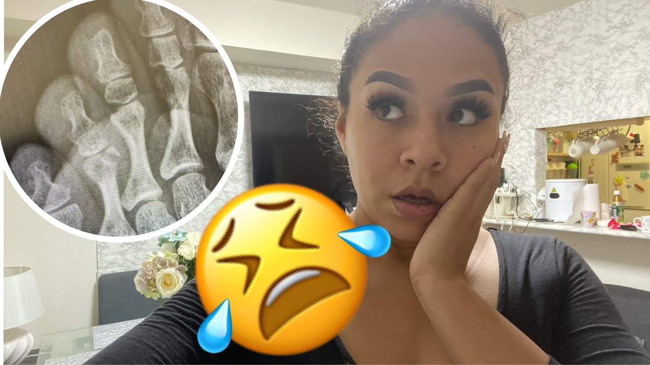 NI SABIA QUE TENIA ROTO EL DEDO - YouTube