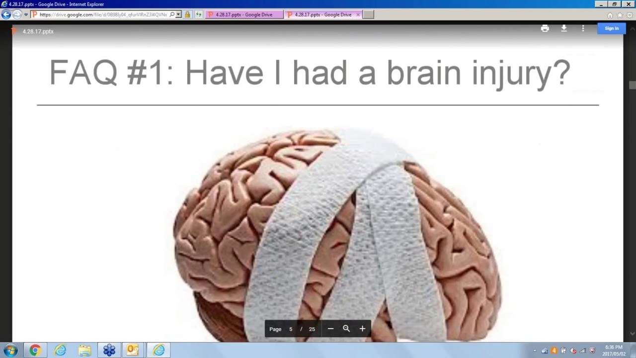 Management of Symptoms of Mild Traumatic Brain Injury - YouTube
