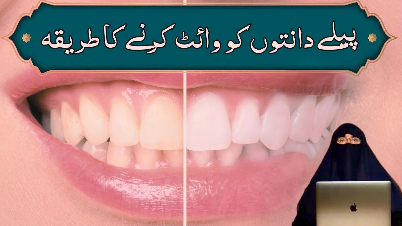 How To Clean Yellow Teeth By Dr Farhat Hashmi | Dr Farhat Hashmi Bayan ...