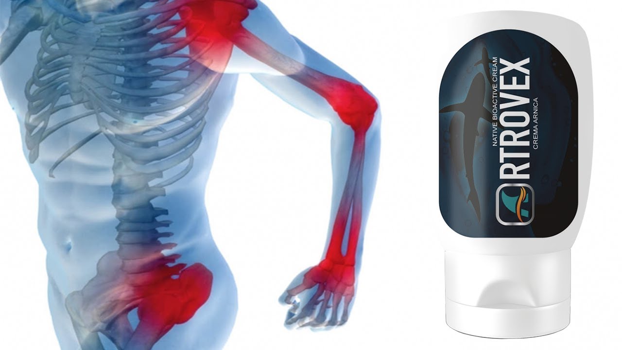 Artrovex Precio - YouTube