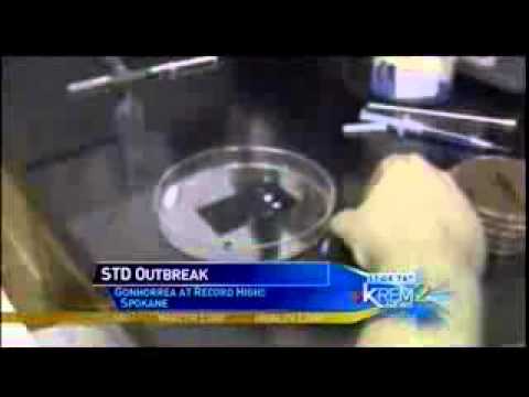 DPR GonorrheaOutbreak KREM1 July2014