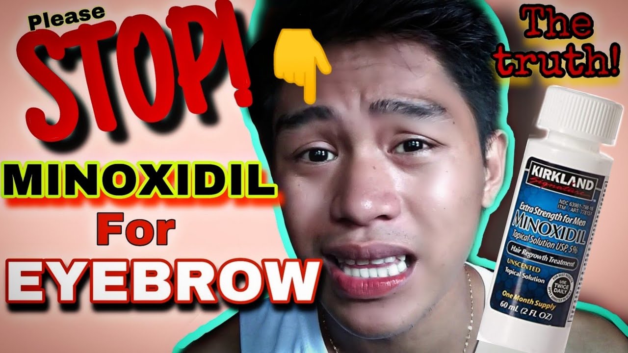 Minoxidil Before And After Eyebrows