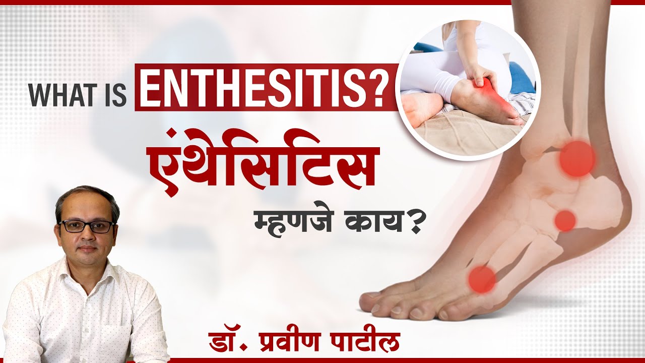 What is Enthesitis? Dr. Pravin Patil | Rheumatologist in Pune - YouTube