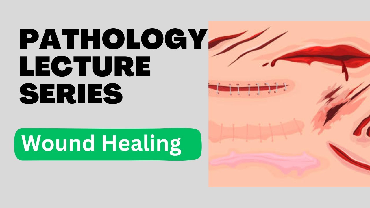 Wound Healing | Pathology Lecture Series | Lecture 5 - YouTube