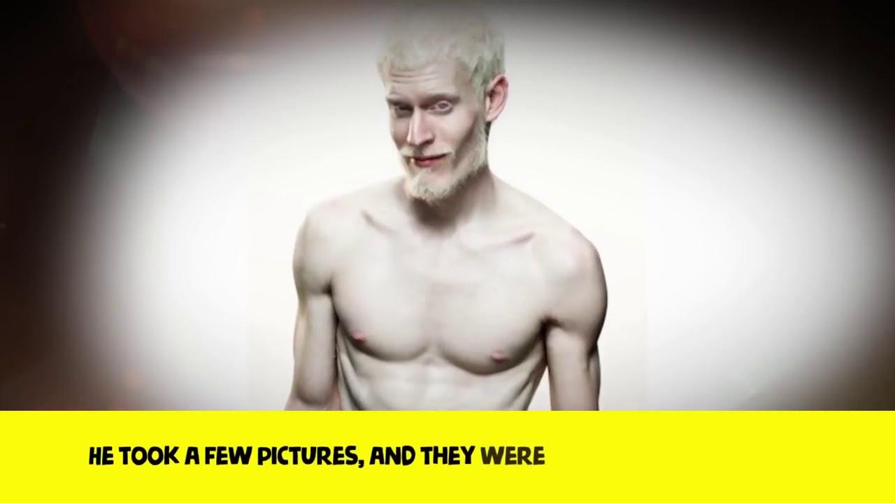 8 Charming People You’ve Never Seen Until Now with unique skin color ...