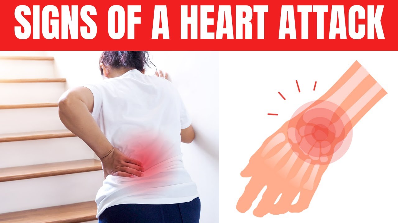 Heart EXPERT Reveals 7 Surprising Signs of Poor Heart Health - YouTube