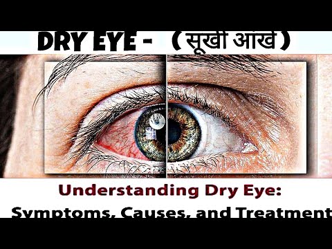 dry eye क्या होता है / dry eye in Hindi / dry eye syndrome in Hindi / # ...