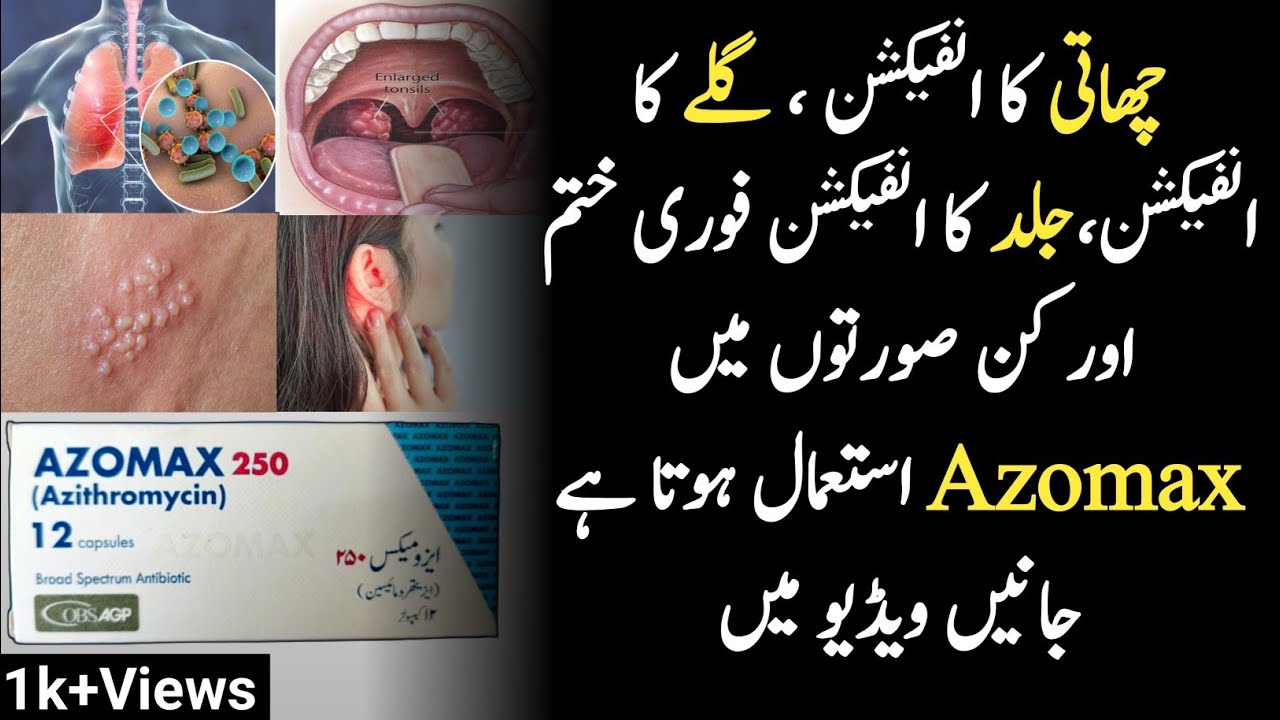 Azomax capsule 250 mg uses | Azomax capsule | benefits | Side effects ...