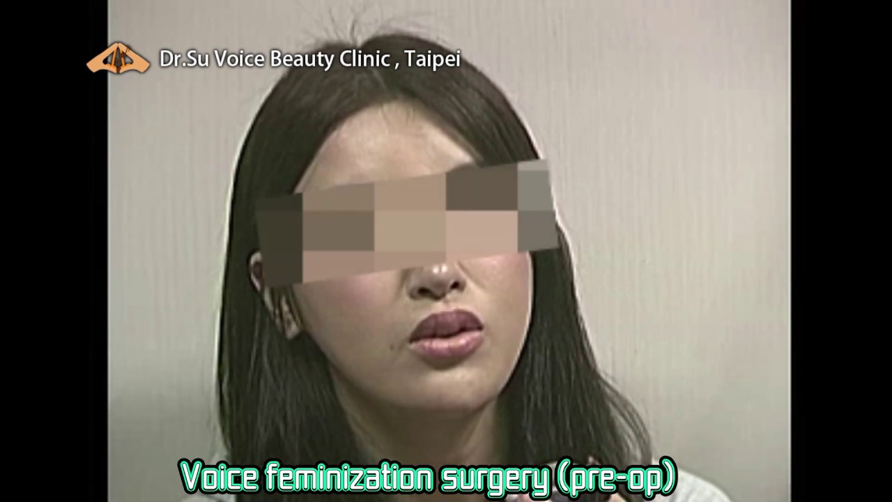 voice feminization surgery (MtF transgender): 聲音女性化手術(MtF跨性別変聲) - YouTube