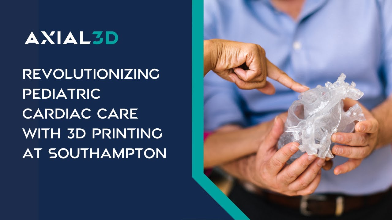 Revolutionizing Pediatric Cardiac Care with 3D Printing at Southampton ...