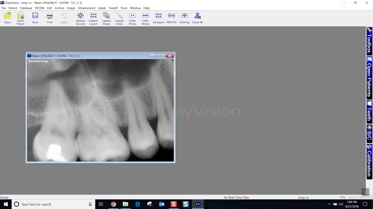 Training: Apteryx XrayVision 4: Moving Images Between Patient Charts ...