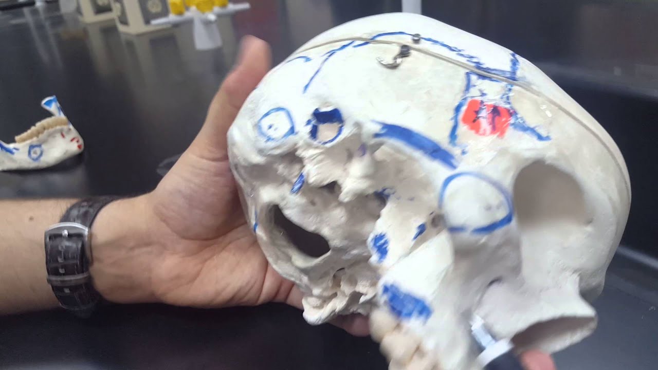 Anatomy Lab - 21 - Head and Neck (Part 03) - YouTube