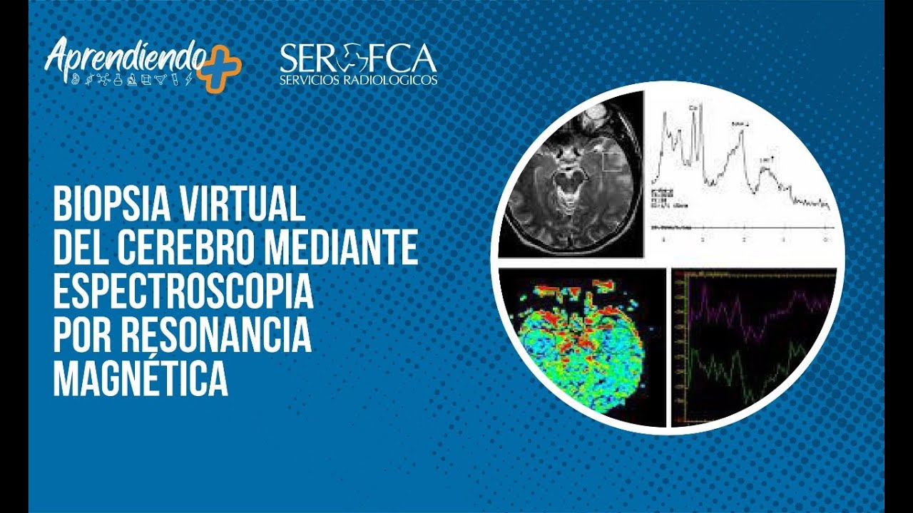 Conversatorio: Biopsia Virtual del Cerebro Mediante Espectroscopia por ...