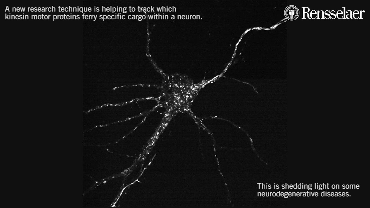 Rensselaer Research Shedding Light on Some Neurodegenerative Diseases ...