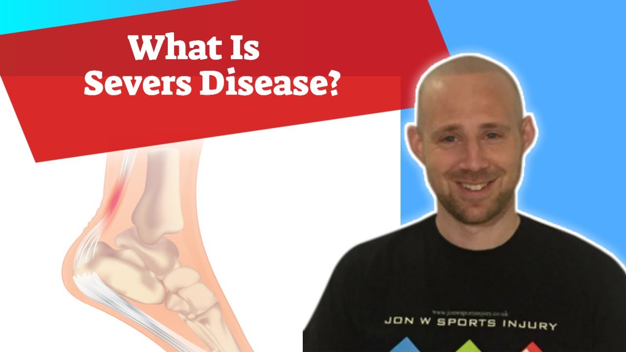 Severs Disease