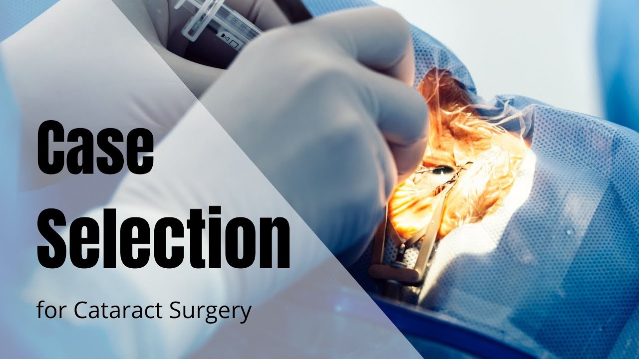 Cataract Surgery : Case Selection for Surgery - YouTube