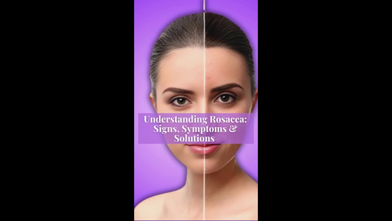 🤔 Is your skin often red, sensitive, or prone to unexpected flare-ups ...