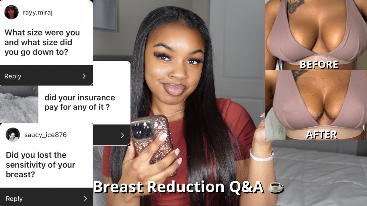 Answering Your Questions About My Breast Reduction Experience