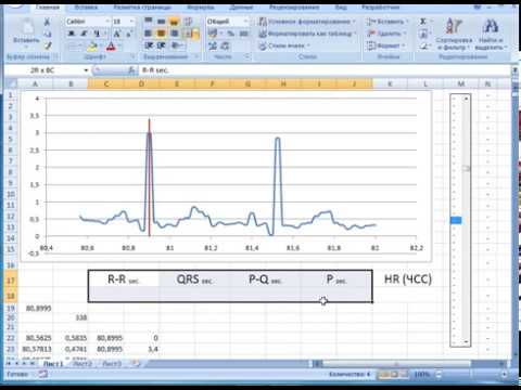 Manipulation ECG in MS Excel (Обработка ЭКГ в MS Excel) - YouTube
