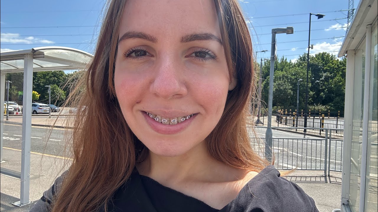 New Bands | New Wires | Closing All My Gaps | Adult Braces Journey ...