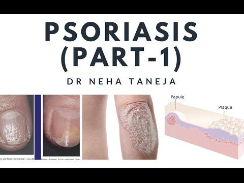 Papulosquamous disorders and Psoriasis(Part-1) - YouTube