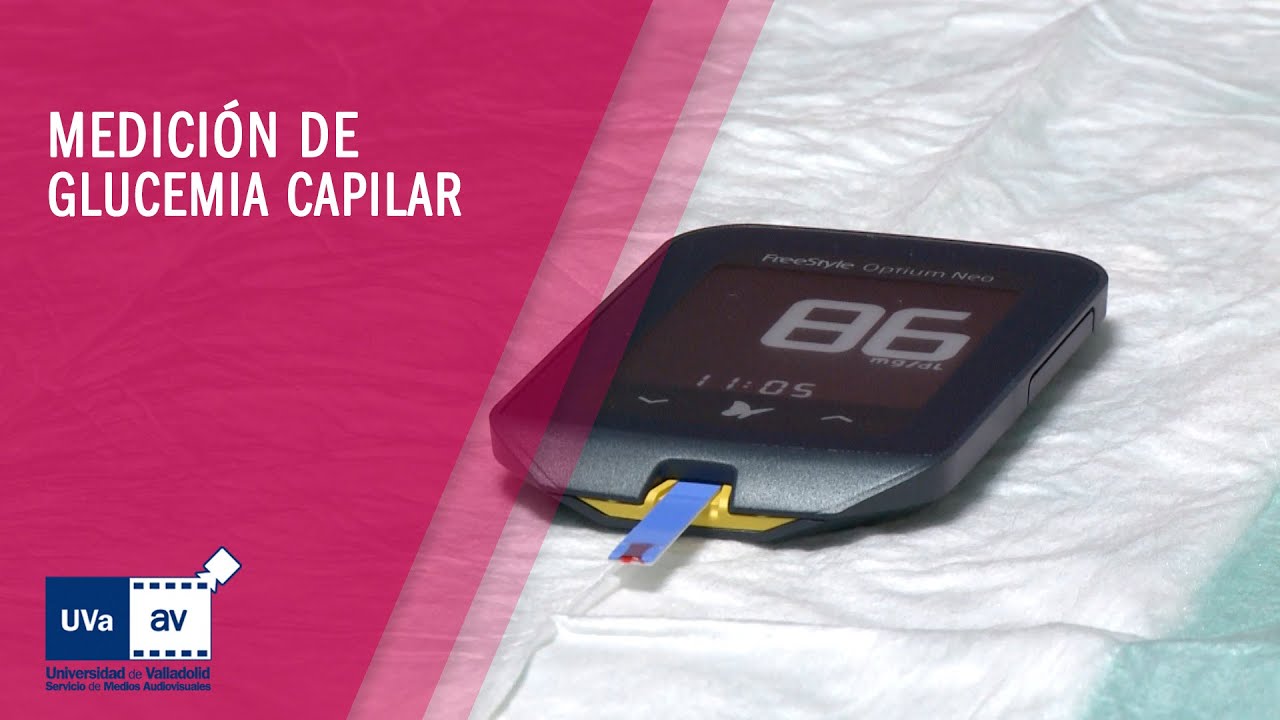 MEDICIÓN DE GLUCEMIA CAPILAR - YouTube