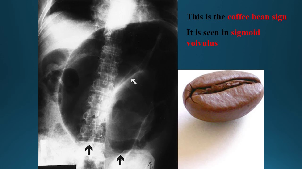 GIT imaging Part 1| radiology | 5th grade | Dr. Sara Mahmoud - YouTube