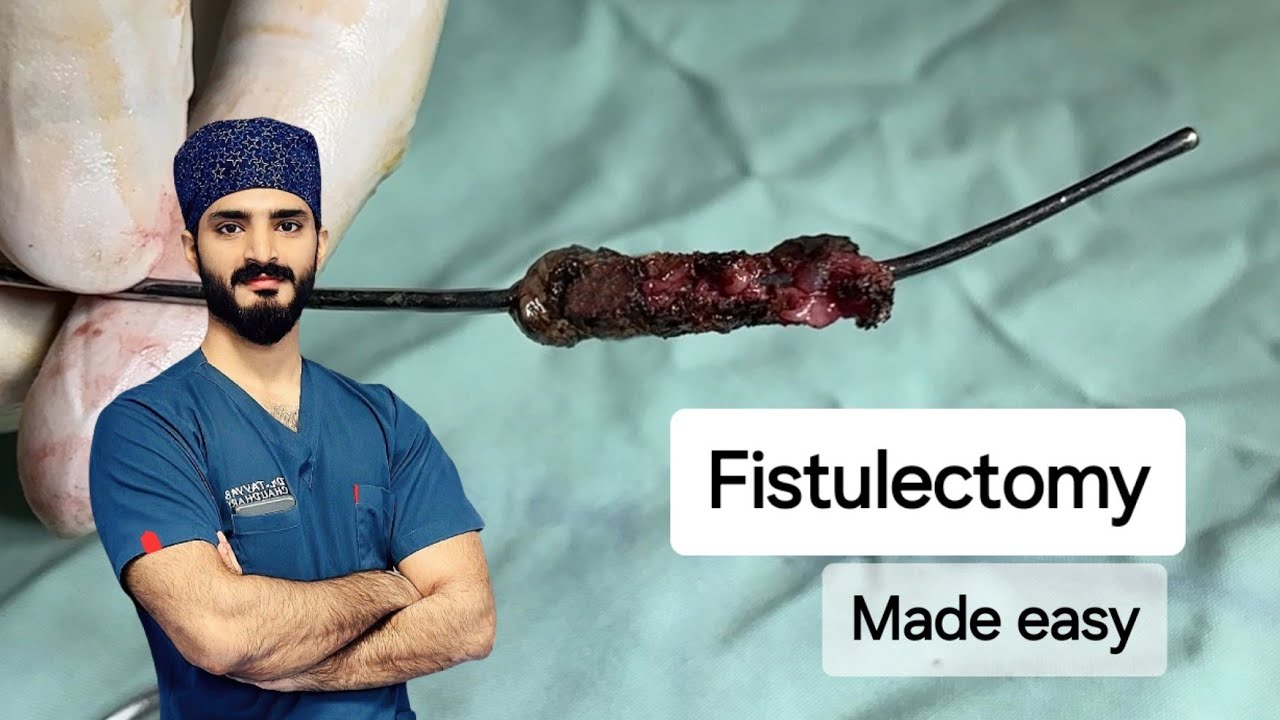 Fistulectomy | Fistula in Ano - Dr Tayyab Riaz Ch - YouTube