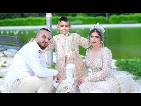 CANLI YAYIN demirdenis Emir Sunnet dugunu