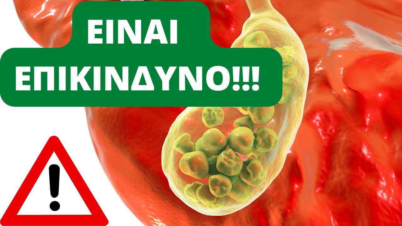 ΧΟΛΟΣΤΑΣΗ!!!ΟΛΟΙ ΠΡΕΠΕΙ ΝΑ ΤΟ ΠΡΟΣΕΧΟΥΜΕ ΚΑΙ ΝΑ ΤΟ ΔΟΥΛΕΥΟΥΜΕ!!! - YouTube