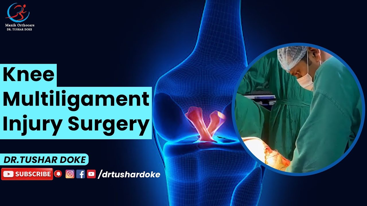 Knee Multiligament Injury Surgery - YouTube