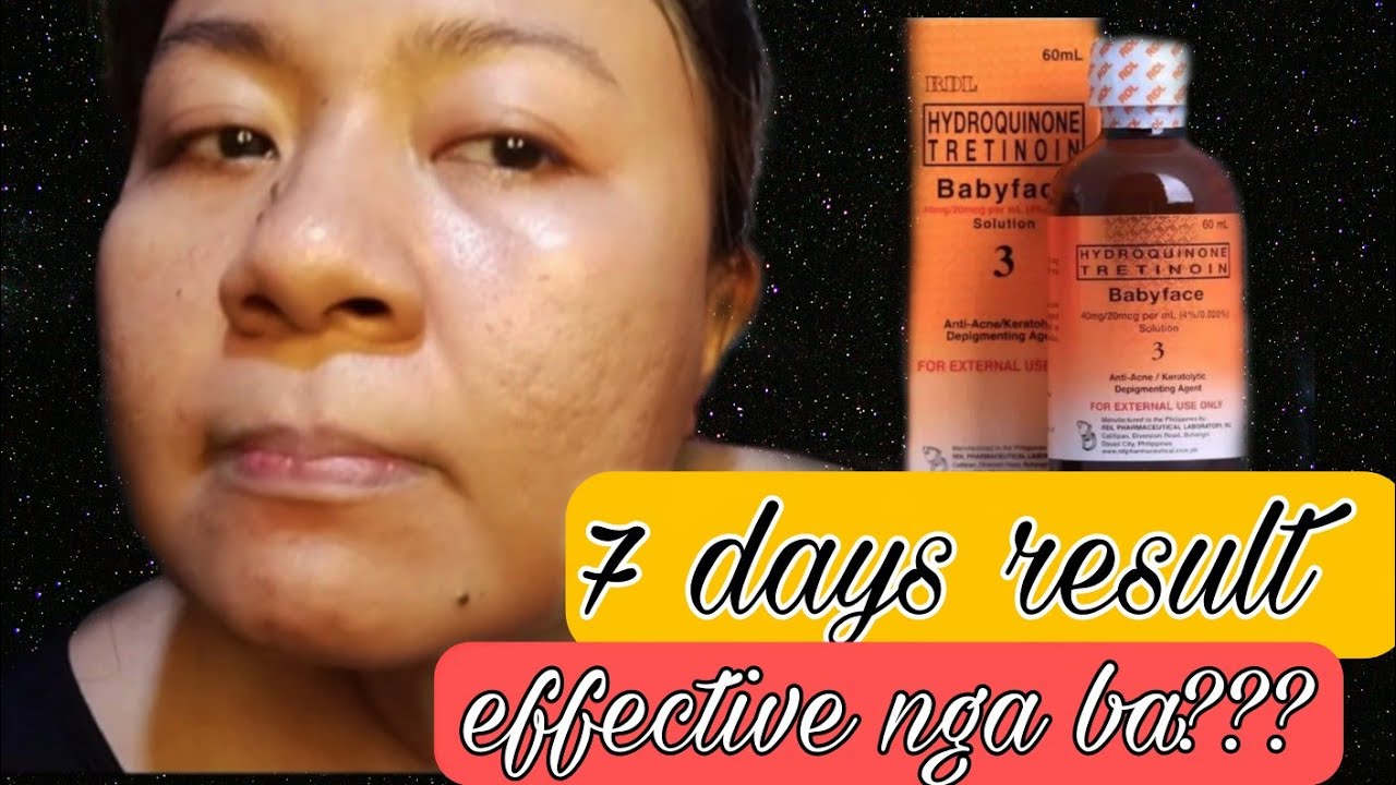 How to use RdL Baby face |Solution #3 | Honest Reviews |Effective Nga ...
