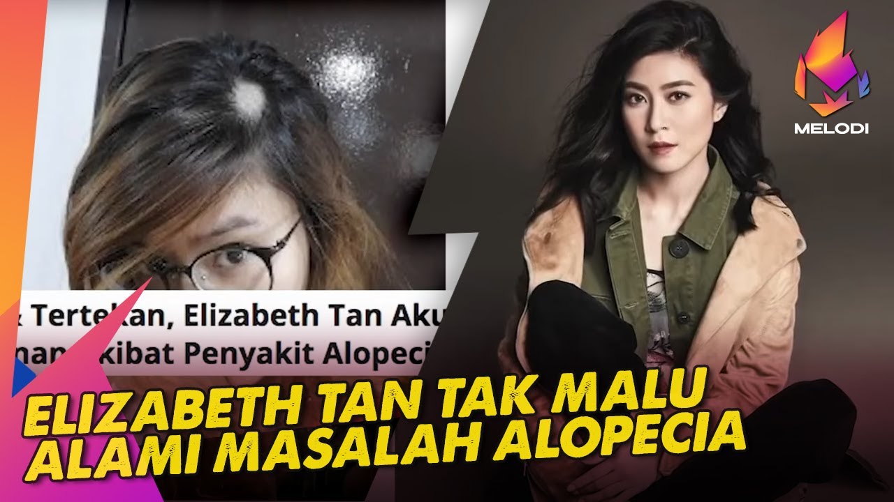 Elizabeth Tan Tak Malu Alami Masalah Alopecia | Melodi (2022) - YouTube