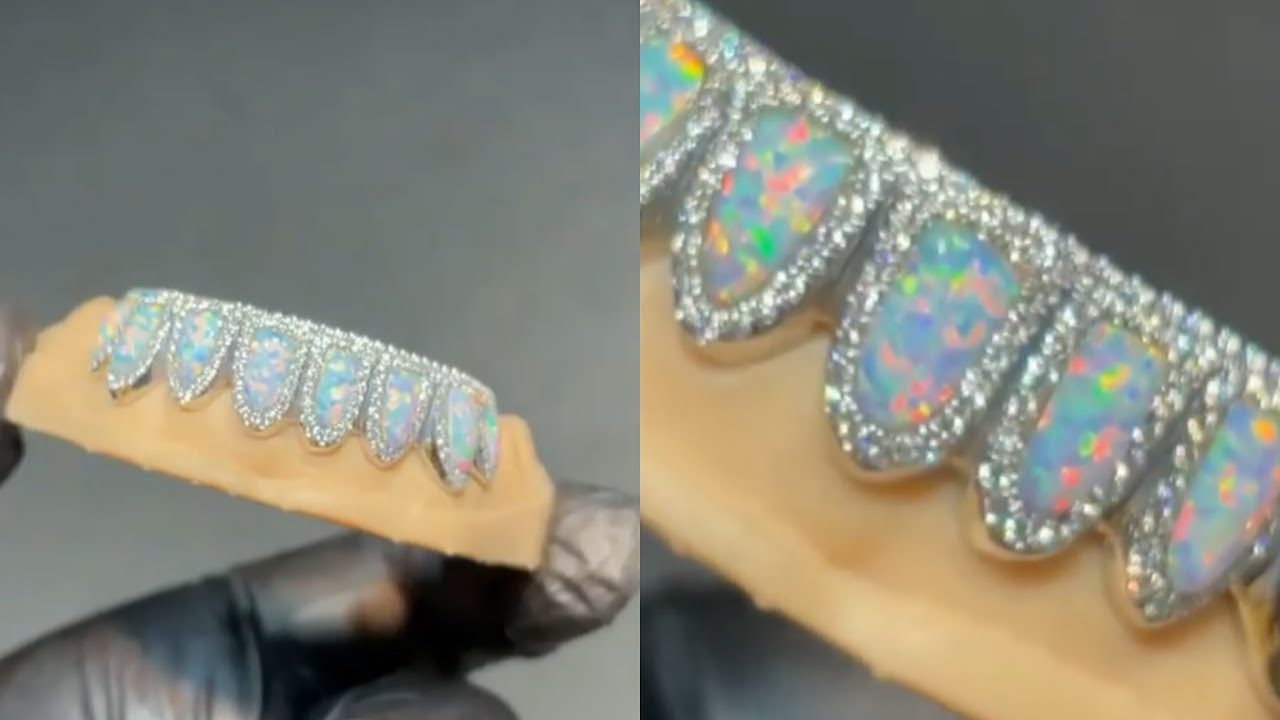 Detailed Look at Iced Out Opal Grill 🔥 - YouTube