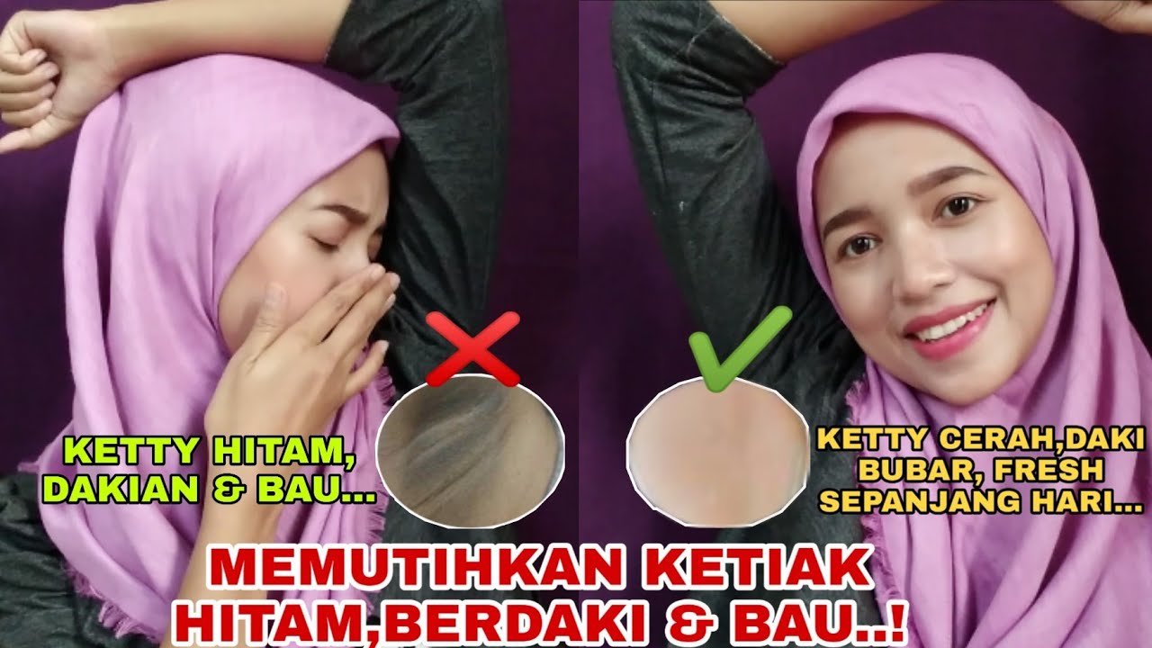 CARA MEMUTIHKAN KETIAK HITAM BERDAKI & BAU - YouTube