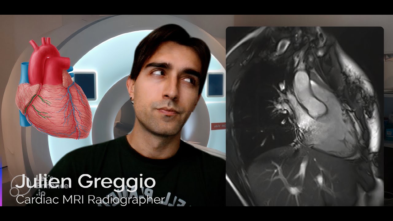 Cardiac MRI Planning - Full Guide (Part 2) - YouTube