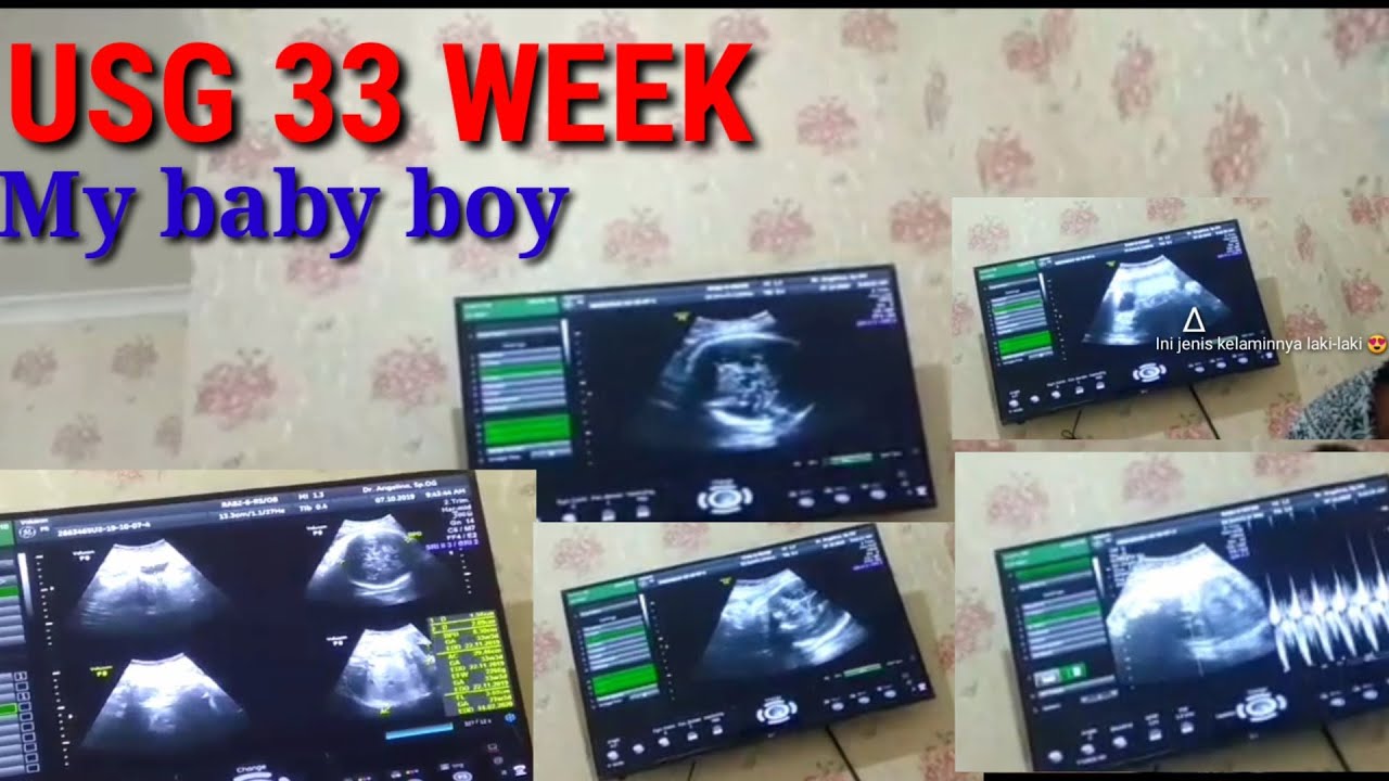 USG 2D USIA KANDUNGAN 33 WEEK/MYBABYBOY - 10 JUNI 2020 - YouTube