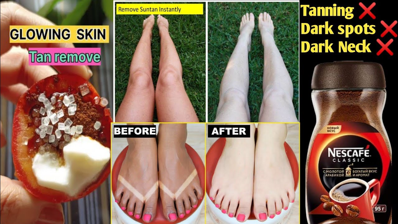 Tan removal Homemade Coffe Scrub |dark Neck, Feet,Elbow,knees |tan ...